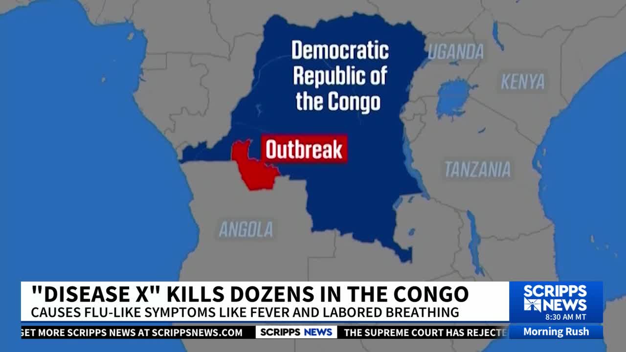 A mystery illness has killed dozens in Congo. UN experts are now ...